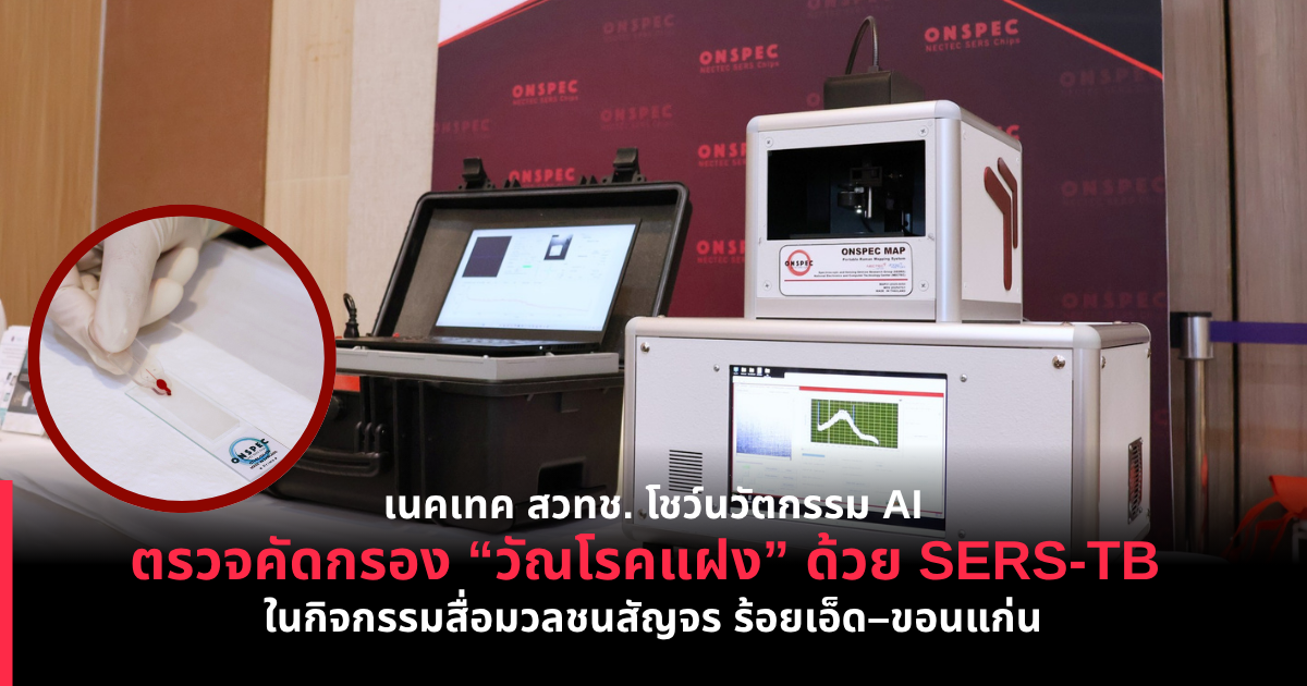 เนคเทค สวทช. โชว์นวัตกรรม AI ตรวจคัดกรอง “วัณโรคแฝง” ด้วย SERS-TB ใน ...